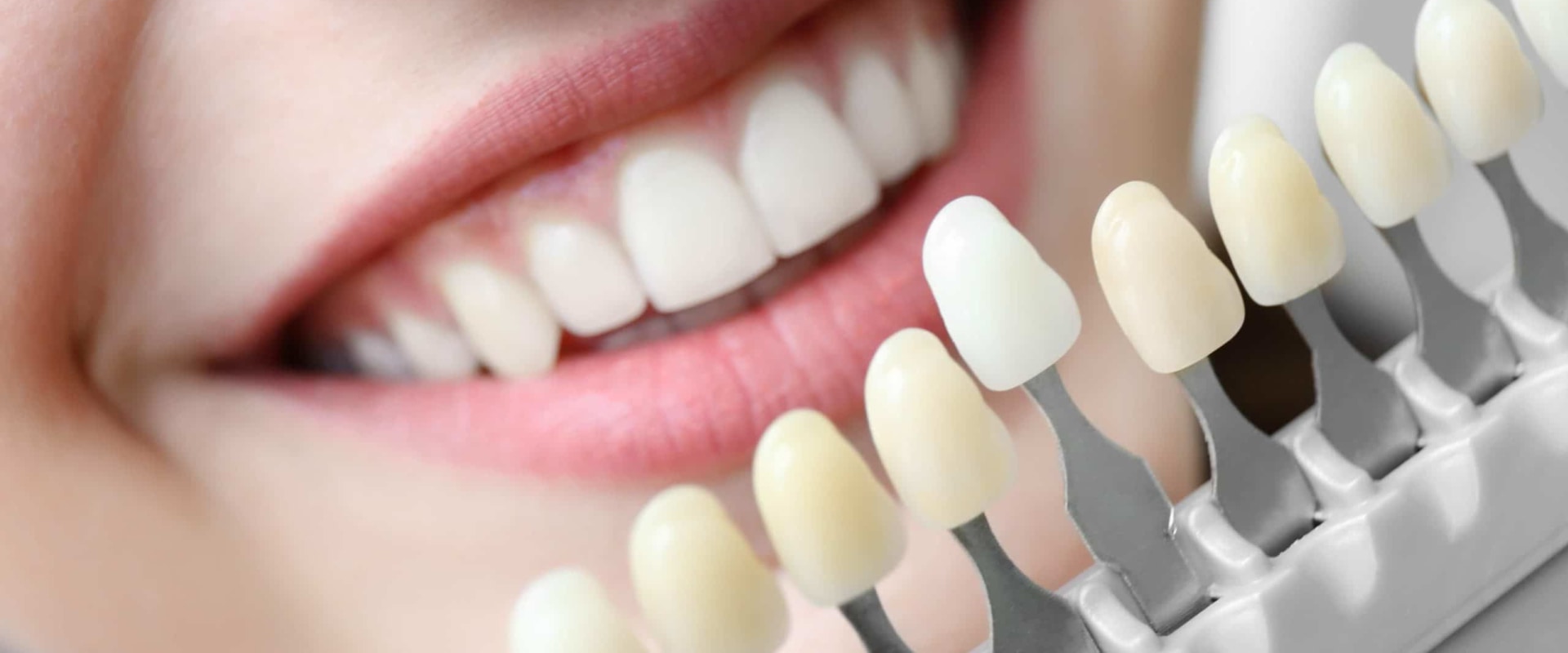 The Best Tooth Change Treatments for Busy People
